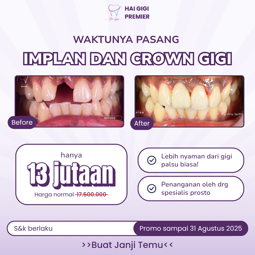Paket Implan dan Crown Gigi - Hai Gigi Premier